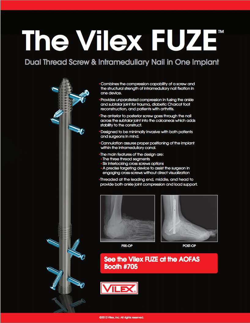 Dr. Neufeld’s Vilex FUZE: Orthopaedic Foot & Ankle Center: Foot and ...