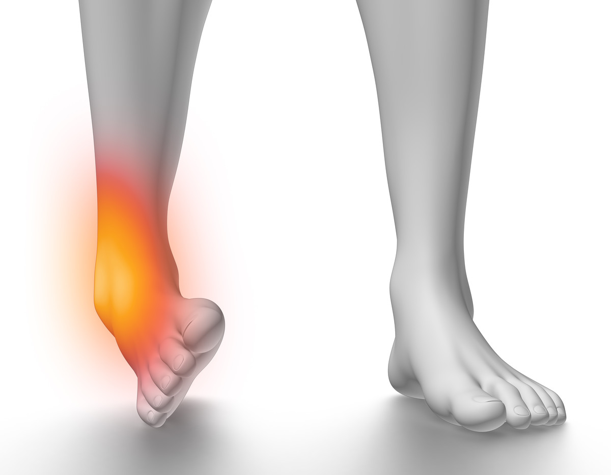 What To Do When Your Ankles Keep Rolling: Understanding Ankle Instability