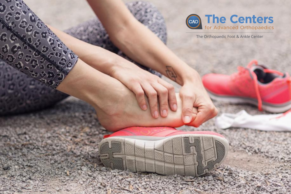 Understanding Bunionettes (Tailor's Bunion): Causes, Symptoms, and ...