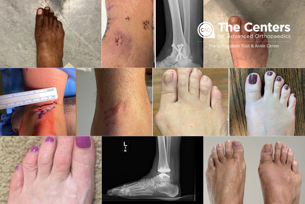 Celebrate Foot Health Awareness Month